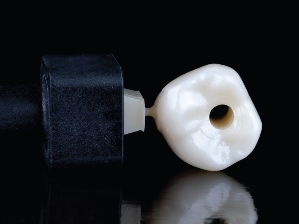 Same-Visit Screw-Retained Crowns: fastmill.io In-Office Mill