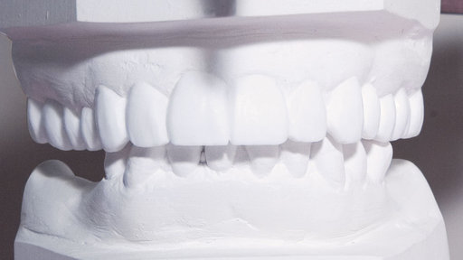 Clinical Technique: Diagnostic Wax-Ups