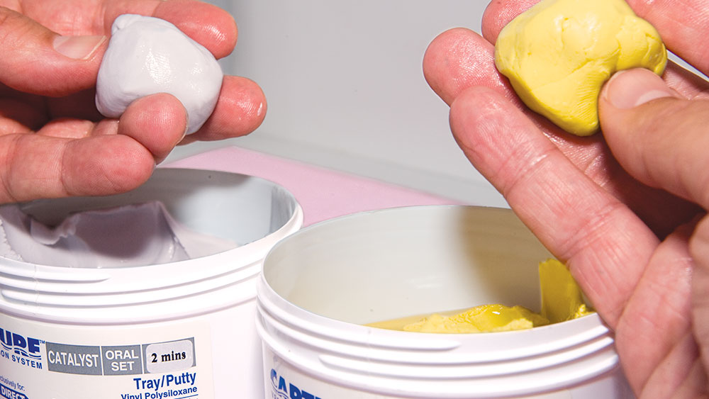 Clinical Technique: Diagnostic Wax-Ups