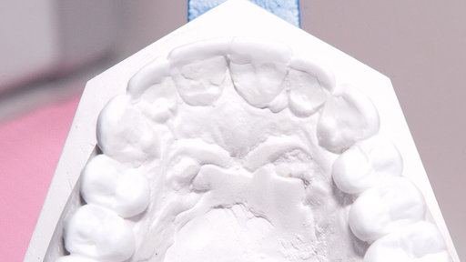 Clinical Technique: Diagnostic Wax-Ups