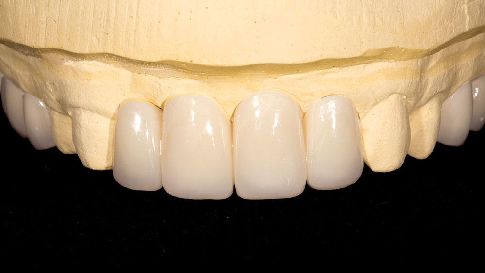 A Unique, Simplified Approach to Post/Buildup Placement with Lab ...