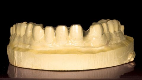A Unique, Simplified Approach to Post/Buildup Placement with Lab ...