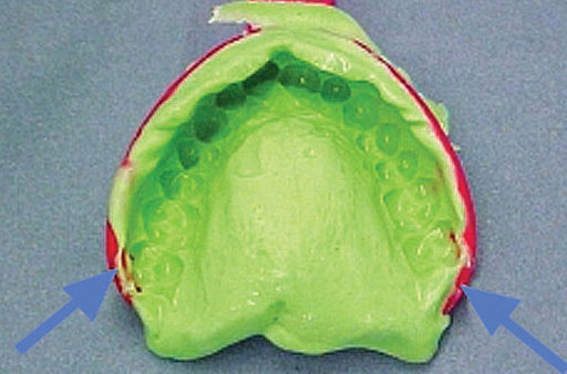 Identification and Correction of Common Impression Problems