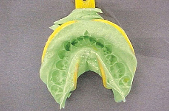 Identification and Correction of Common Impression Problems