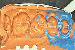 Identification and Correction of Common Impression Problems