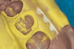 Identification and Correction of Common Impression Problems