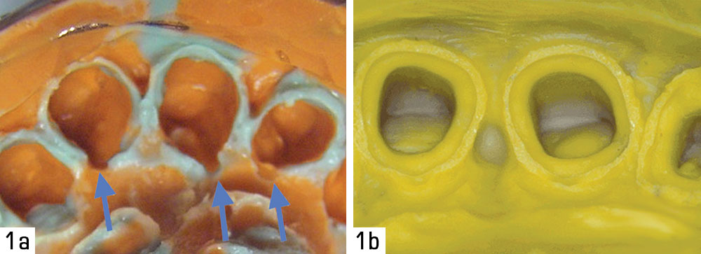 Identification and Correction of Common Impression Problems