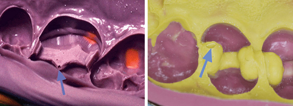 Identification and Correction of Common Impression Problems