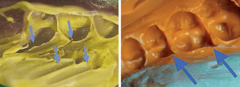 Identification and Correction of Common Impression Problems