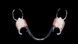 Valplast Clinical Indications