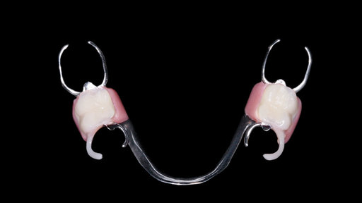 Valplast Clinical Indications