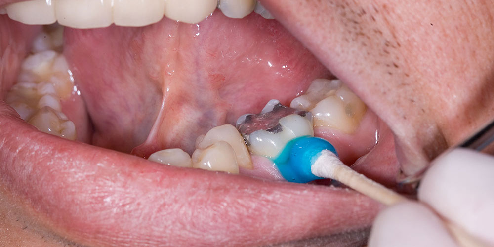 Rapid Anesthesia Photo Gallery