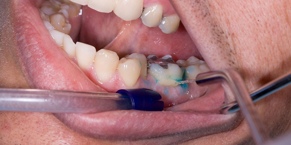 Rapid Anesthesia Photo Gallery