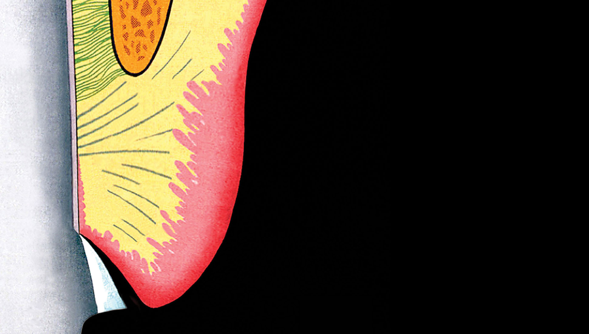 Using Margin Placement to Achieve the Best Anterior Restorative Esthetics