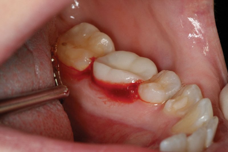 Biologic Shaping