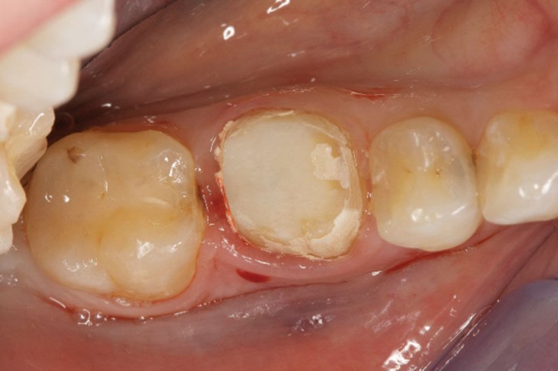 Biologic Shaping