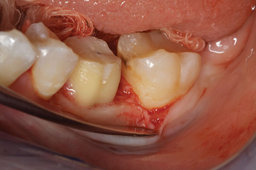 Biologic Shaping