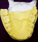 Alginate Substitutes: Rationale for Their Use