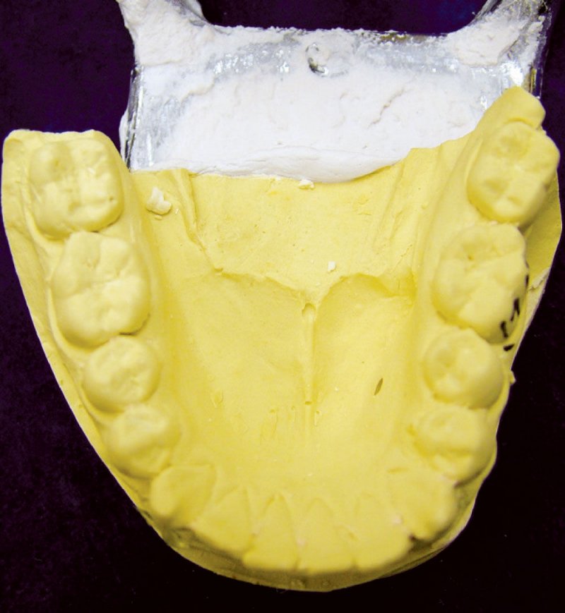 Alginate Substitutes: Rationale for Their Use