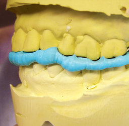 Alginate Substitutes: Rationale for Their Use