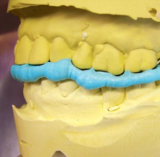 Alginate Substitutes: Rationale for Their Use