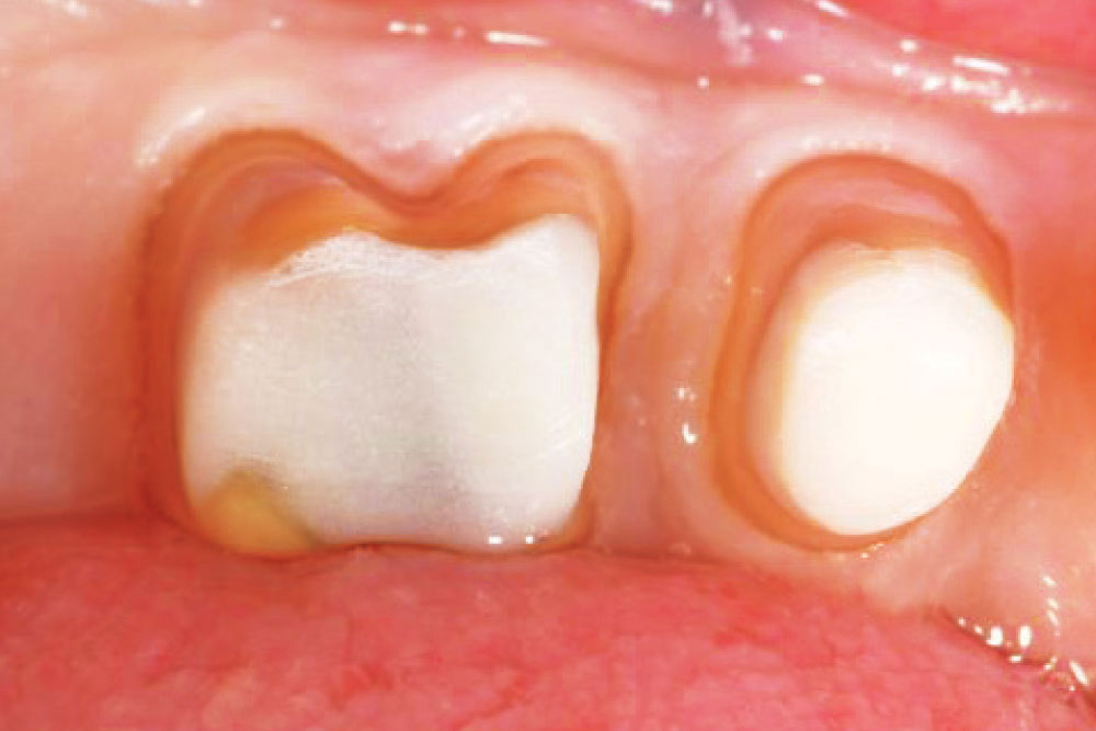 Periodontal Photo Essay