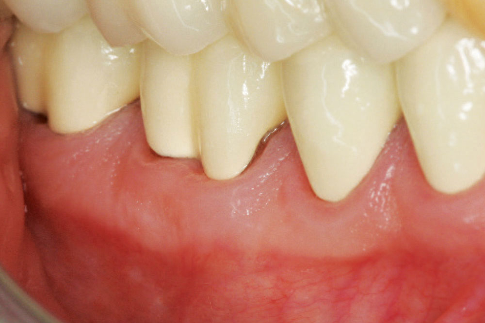 Periodontal Photo Essay