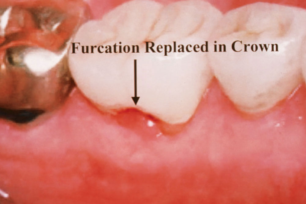 Periodontal Photo Essay