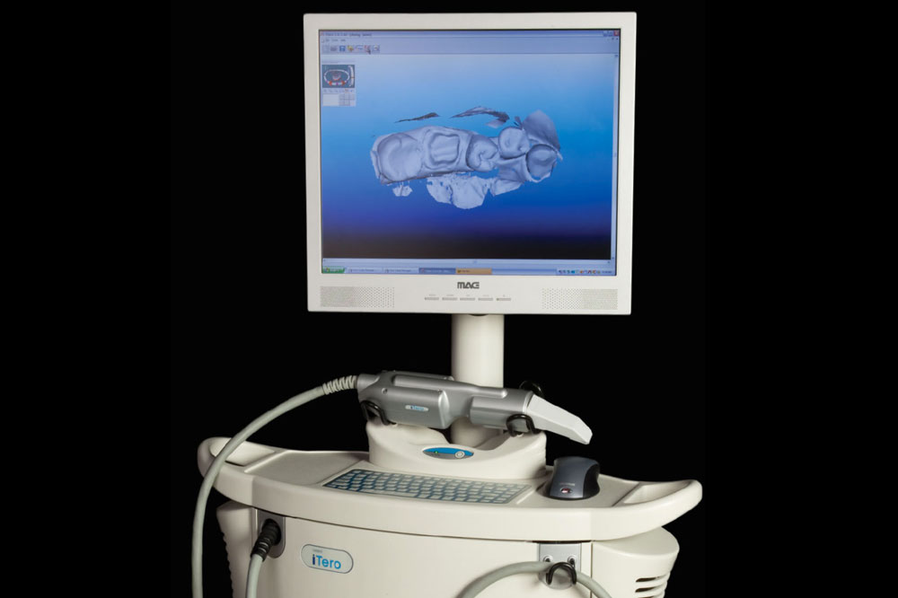 CEREC® Connect: A Welcomed Upgrade for CEREC Users