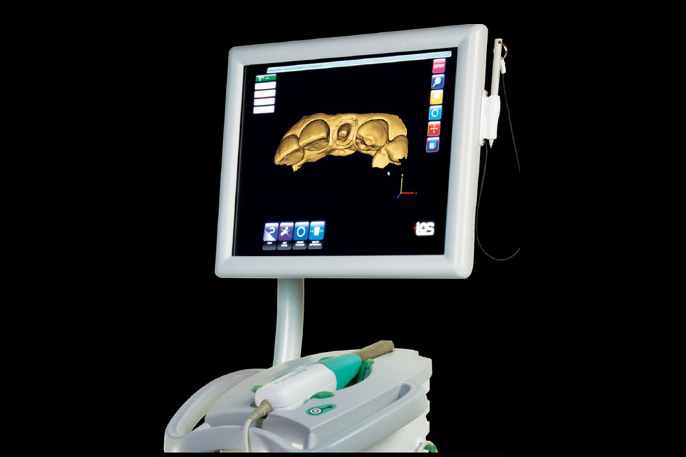 CEREC® Connect: A Welcomed Upgrade for CEREC Users