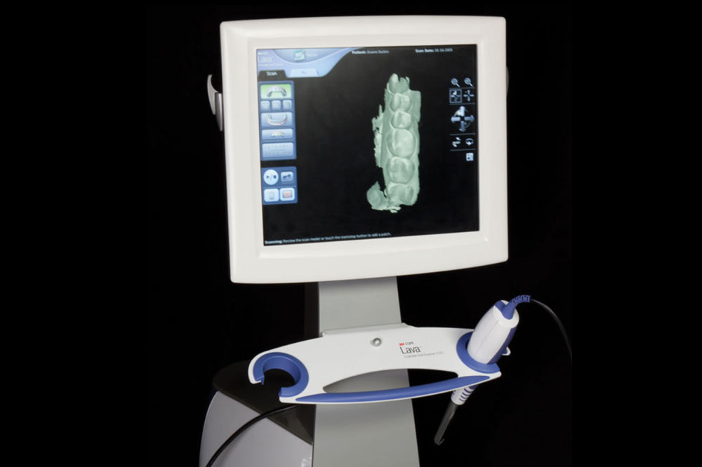 CEREC® Connect: A Welcomed Upgrade for CEREC Users