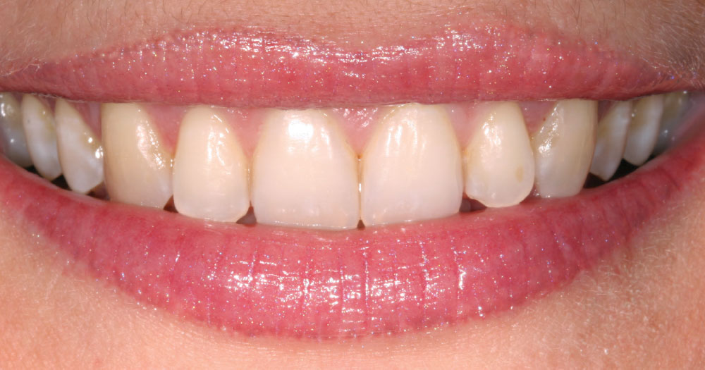 Dental Photography: A New Perspective