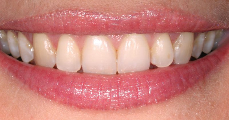 Dental Photography: A New Perspective