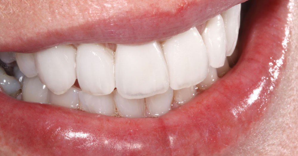 Dental Photography: A New Perspective