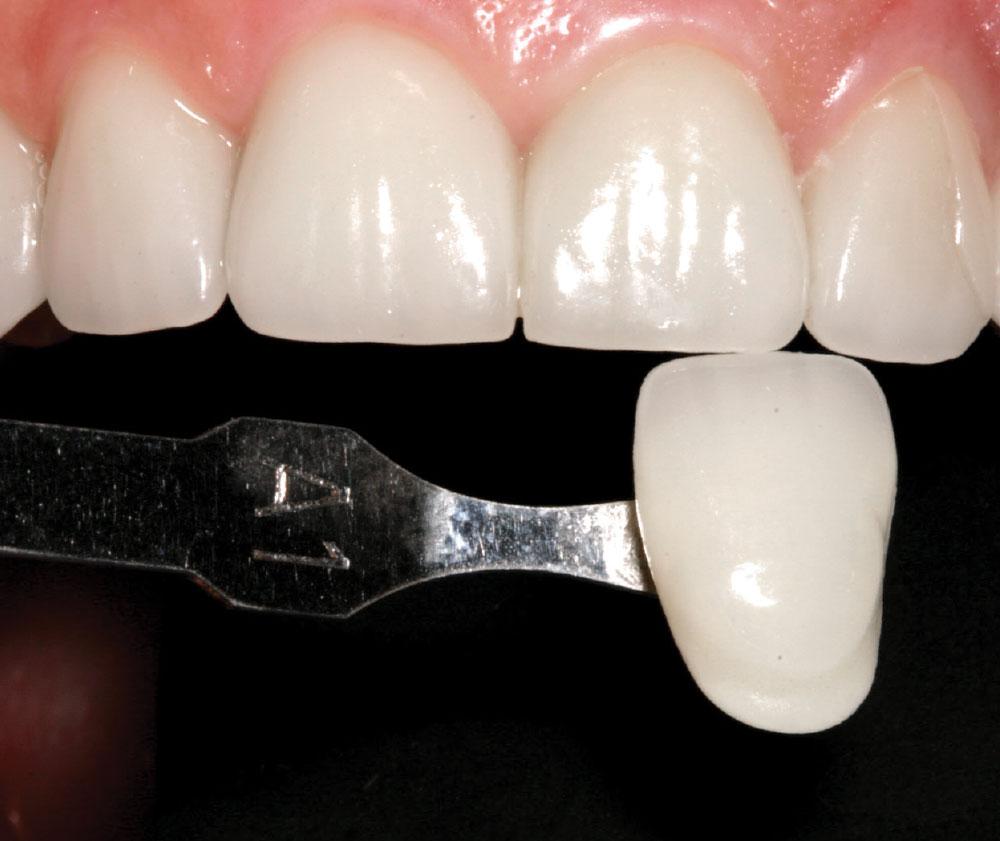 Dental Photography: A New Perspective