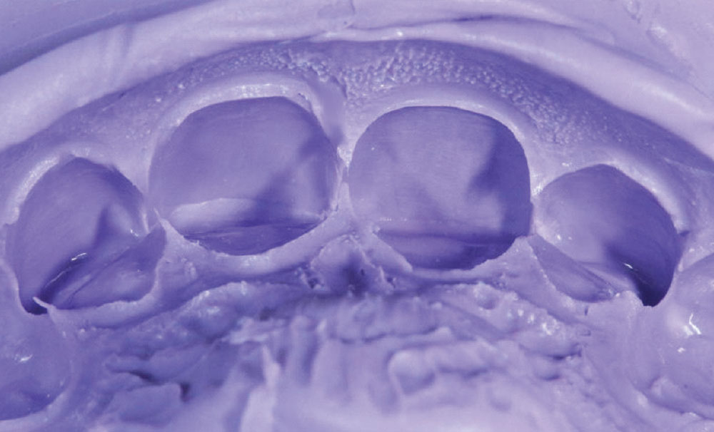 Aesthetic Treatment of Dark Root Syndrome