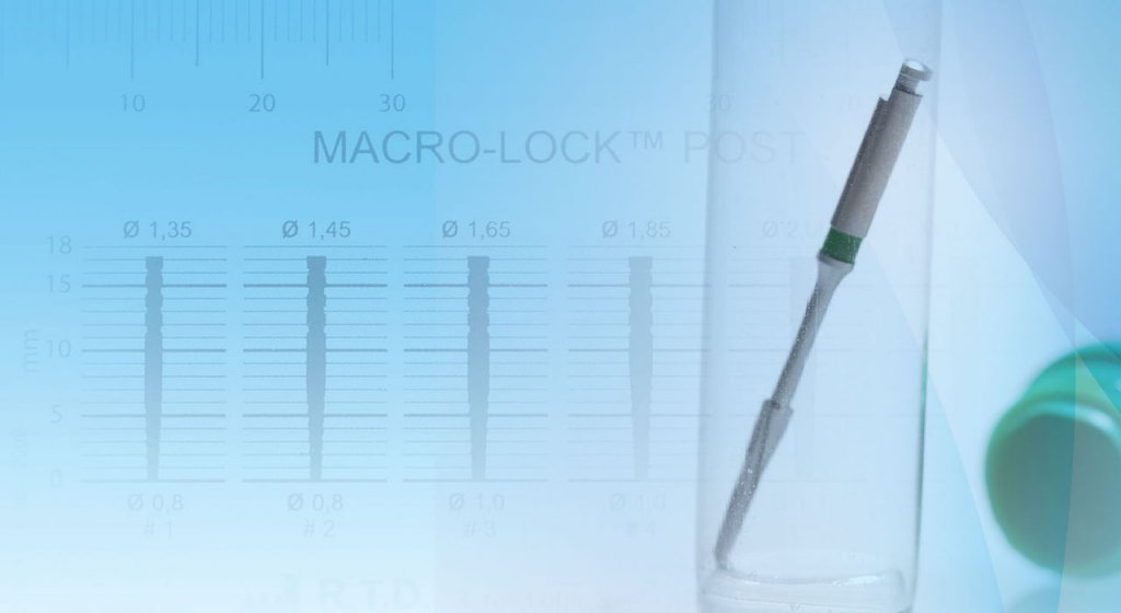 Clinical Predictability Using Fiber Posts
