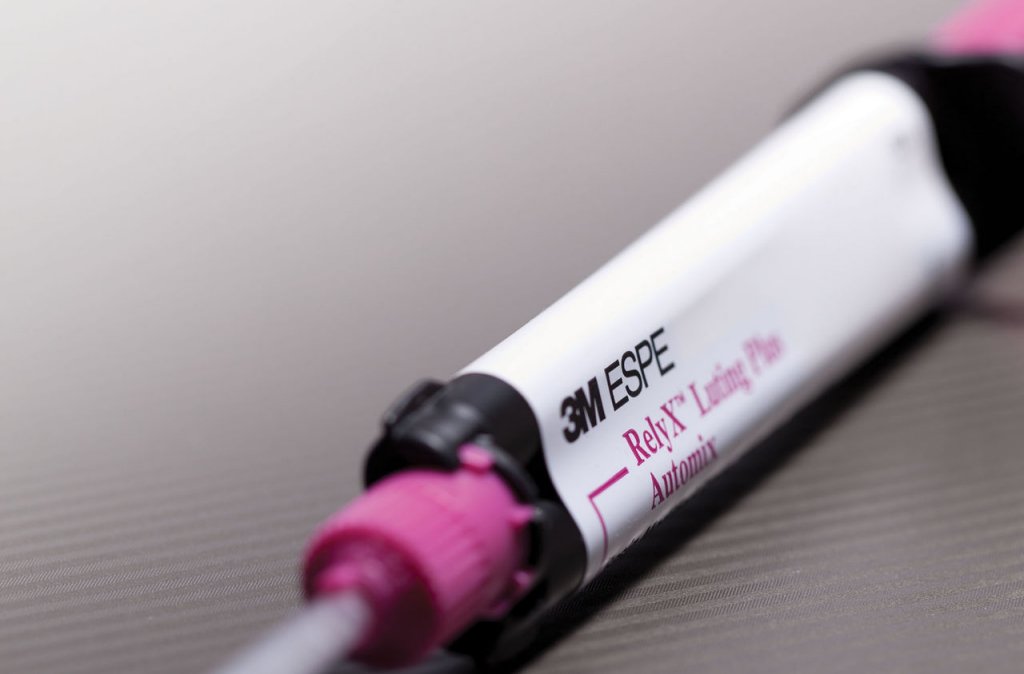 Dr. DiTolla's Clinical Tips – RelyX™ Luting Plus Automix