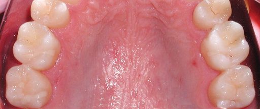 An Introduction to Dental Photography