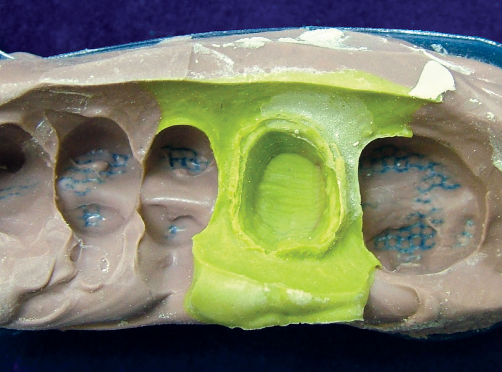 Faster Is Not Always Better When It Comes to Impressioning