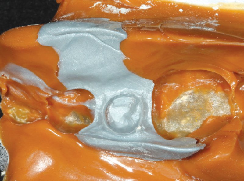Faster Is Not Always Better When It Comes to Impressioning