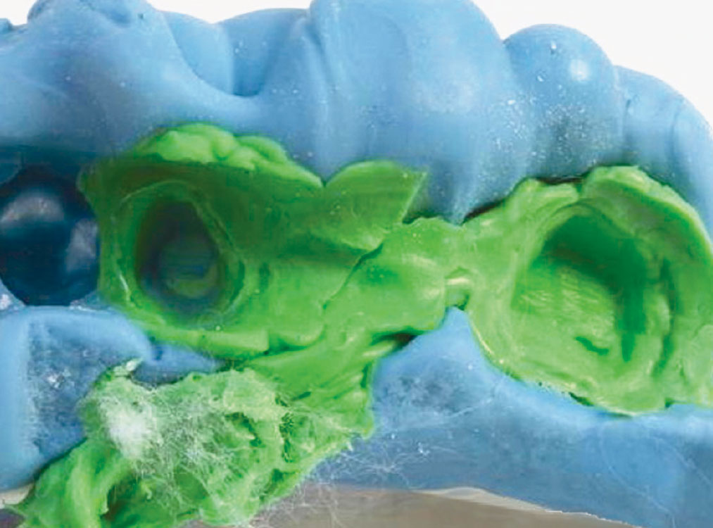 Faster Is Not Always Better When It Comes to Impressioning