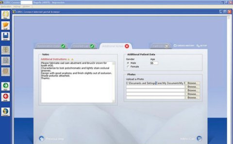 Scannable Abutments: Digital Impressions for Dental Implants