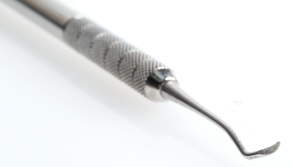 Speed Dentistry: Fast Is Better — Up to a Point