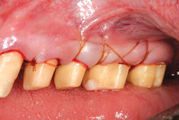 Biologic Shaping from a Restorative Perspective