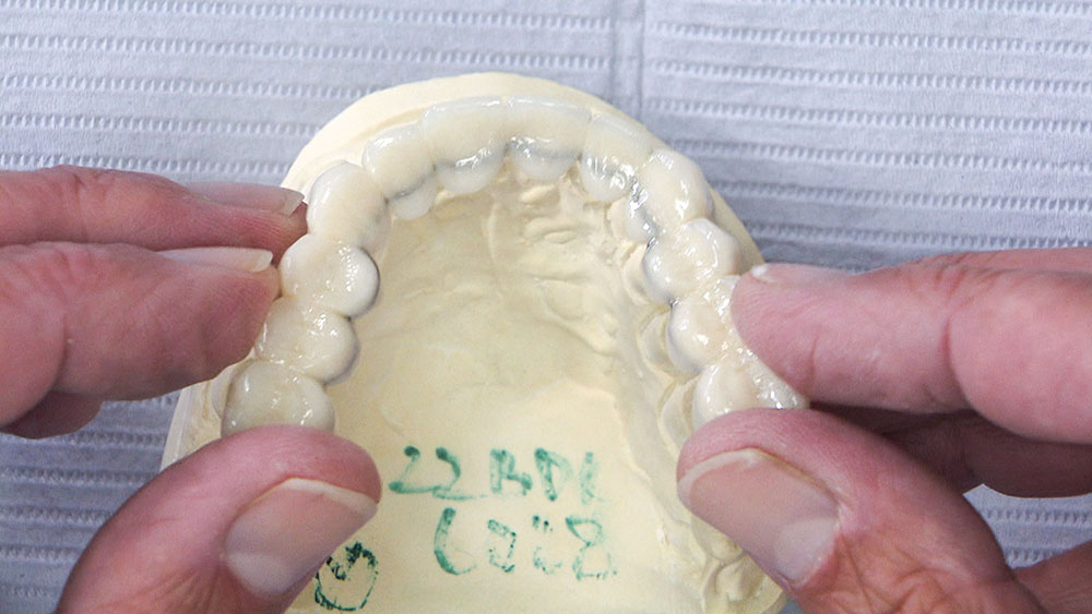 BioTemps Tips and Tricks for Successful Seating – Case of the Week ...