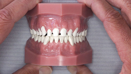 BioTemps Tips and Tricks for Successful Seating – Case of the Week ...