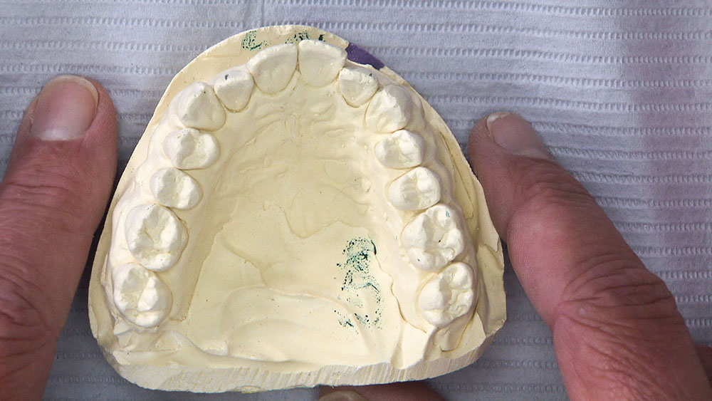 BioTemps Tips and Tricks for Successful Seating – Case of the Week ...