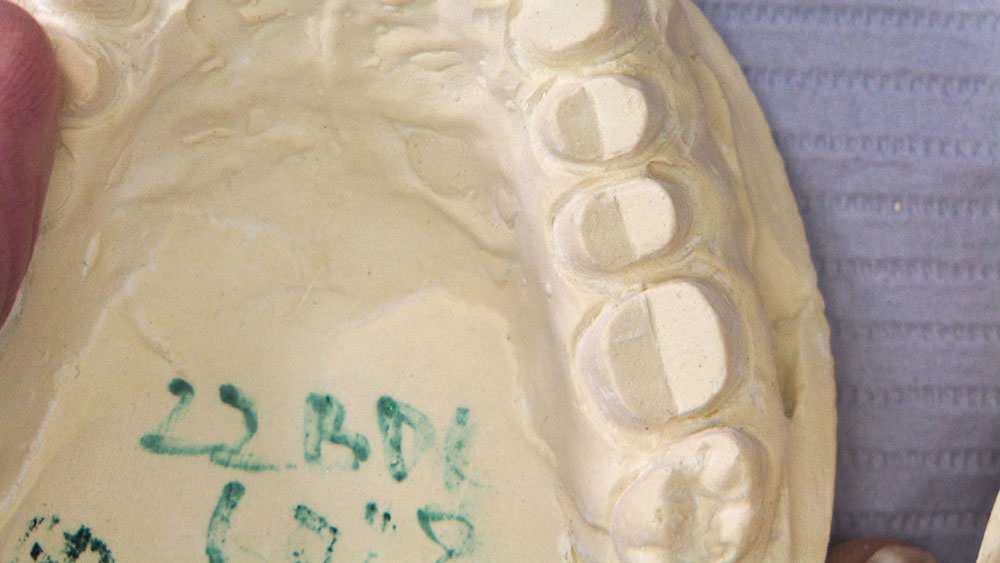 BioTemps Tips and Tricks for Successful Seating – Case of the Week ...