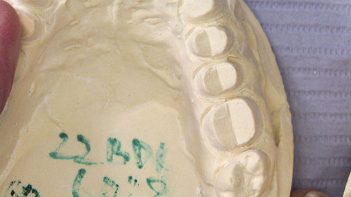 BioTemps Tips and Tricks for Successful Seating – Case of the Week ...